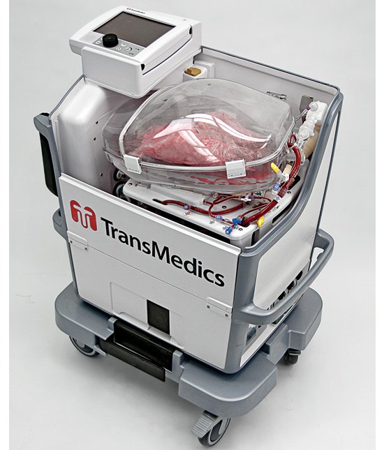 L'OCS (Organ Care System) révolutionne la greffe