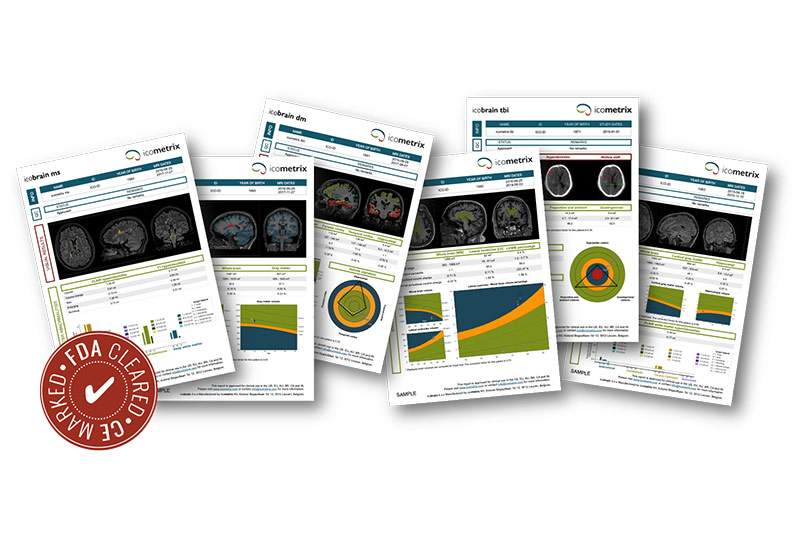 icometrix, leader dans l'intelligence artificielle pour l'imagerie ...