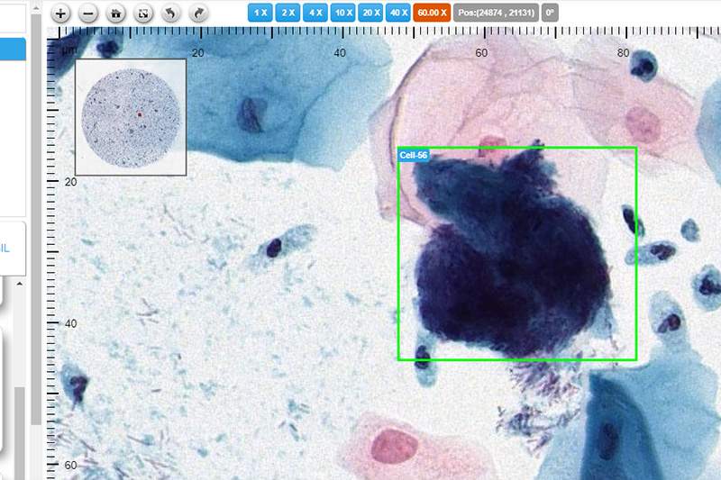 OptraSCAN annonce CytoSiA, une solution numérique complète pour la ...