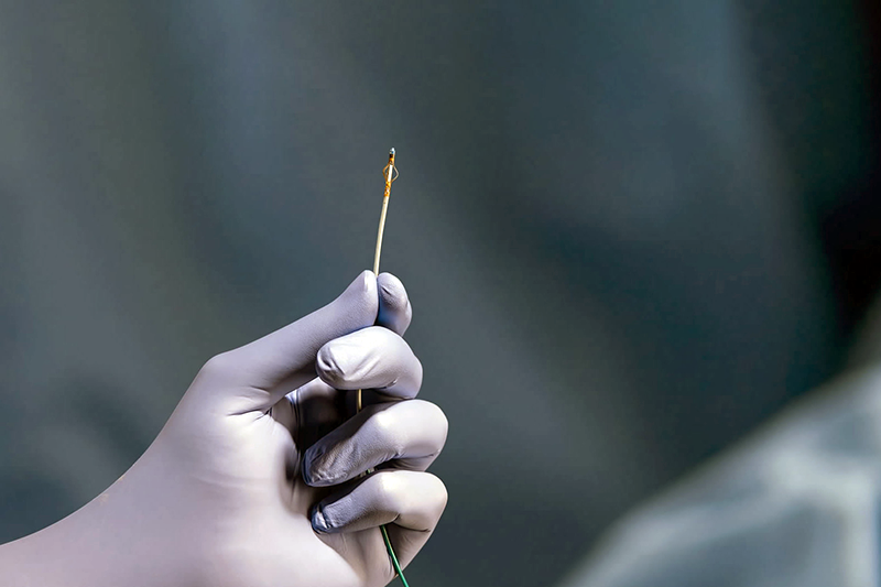 SoniVie reçoit l'approbation IDE de la FDA pour son étude pilote sur le ...