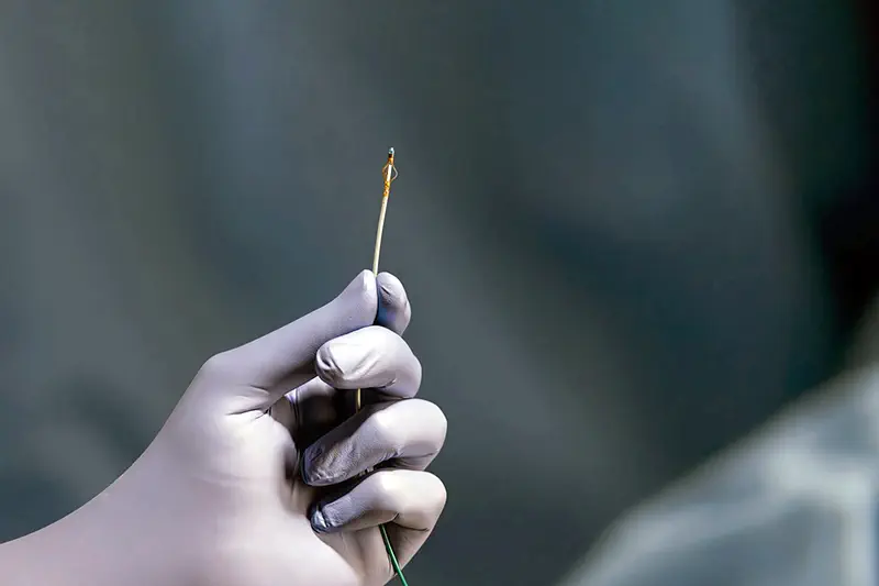 SoniVie reçoit l'approbation IDE de la FDA pour son étude pilote sur le ...